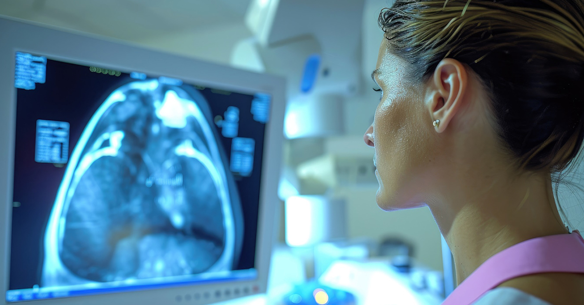 BioZorb Lawsuit Lawyer - Breast Biopsy Marker Recall - July 2025 Update